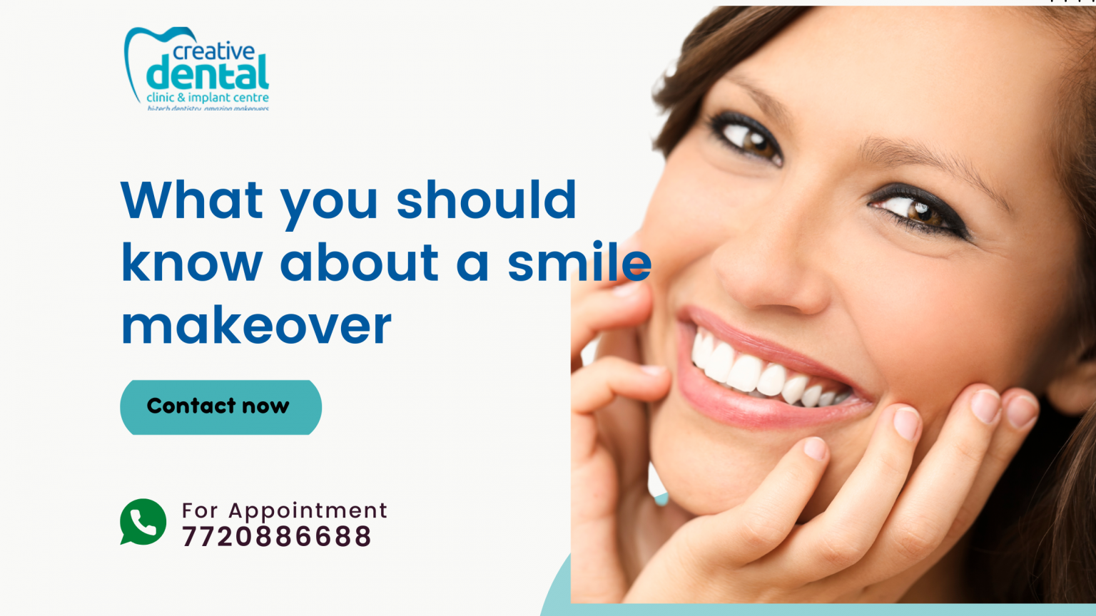 What You Should Know About A Smile Makeover.